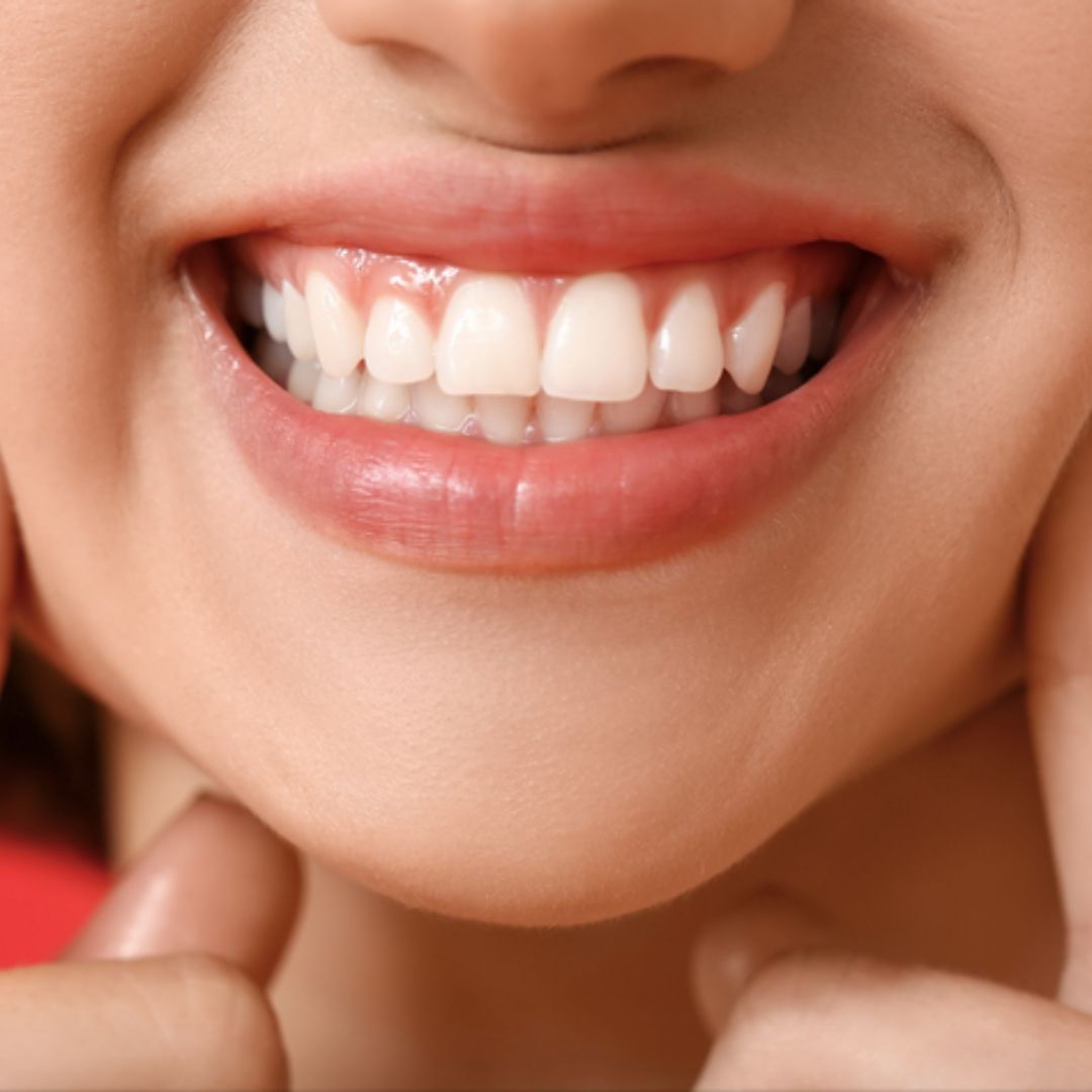 Achieving the Perfect Smile with Gum Contouring – LIFESTYLE BY PS