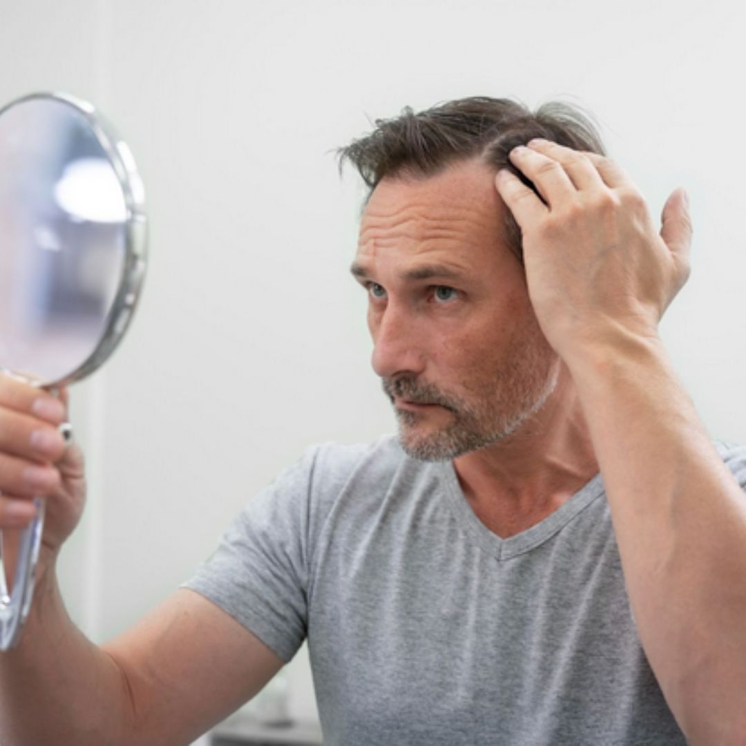 5 Best Hair Loss Treatment Options for Men – LIFESTYLE BY PS
