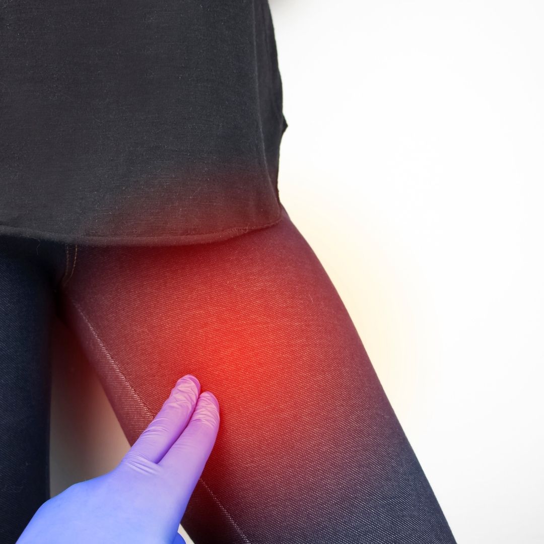 CAUSES AND TREATMENT METHODS FOR INNER THIGH CHAFING – LIFESTYLE BY PS